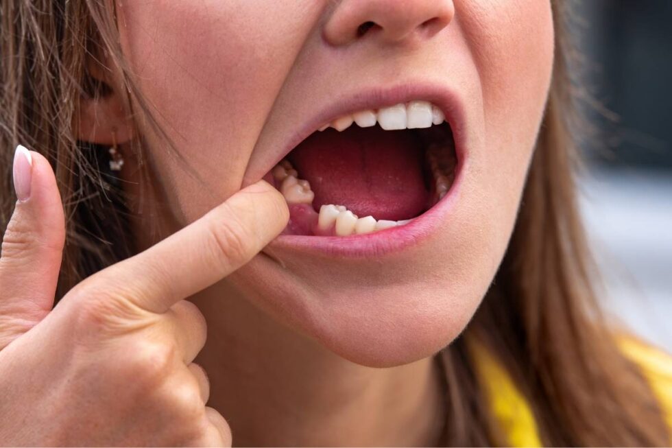 How to Identify Dry Socket: Dentist Tips on Symptoms & Treatment